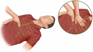 How to Perform CPR – Step by Step Instructions