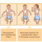 CPR for Infants (up to 12 months) | Step by Step Guide