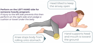 CPR - Pregnancy | Step by Step Guide